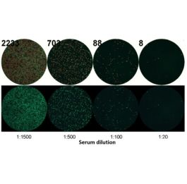 ImmunoSpot® - Neutralizing Antibody (NAb) assays