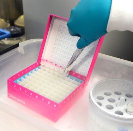 PBMC Processing Services | ImmunoSpot®